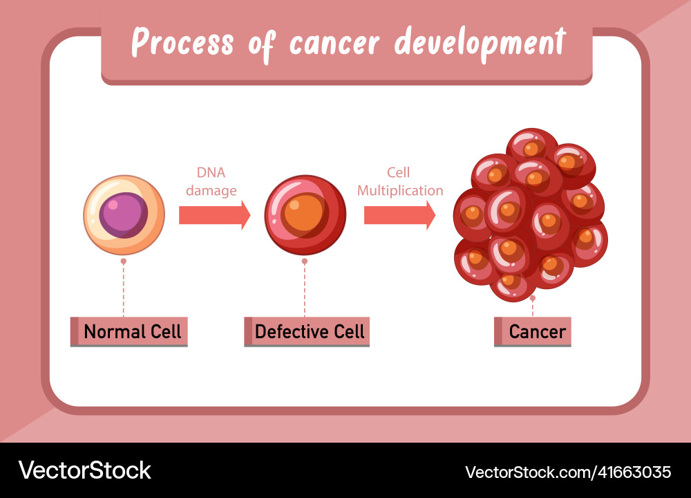 Process of cancer development infographic Vector Image