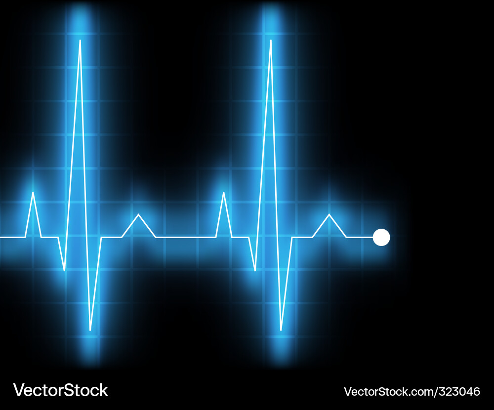 Electrocardiogram ecg Royalty Free Vector Image