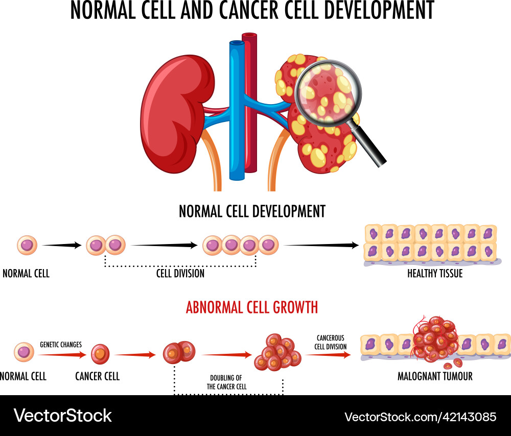 Diagram showing normal and cancer cell Royalty Free Vector