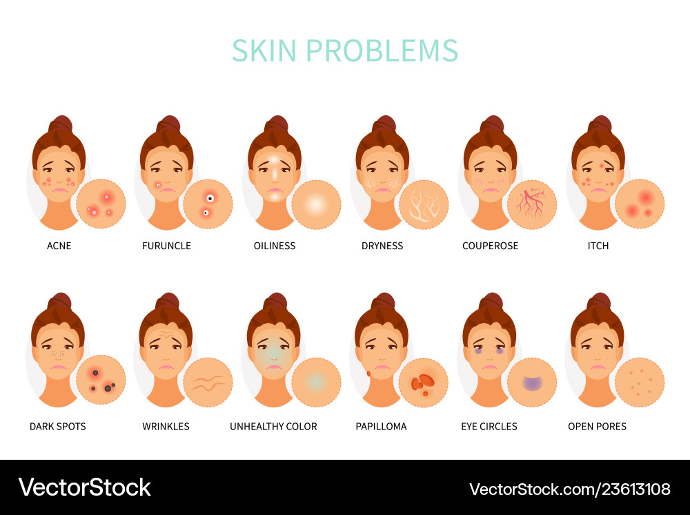 Skin Condition Problems Royalty Free Vector Image