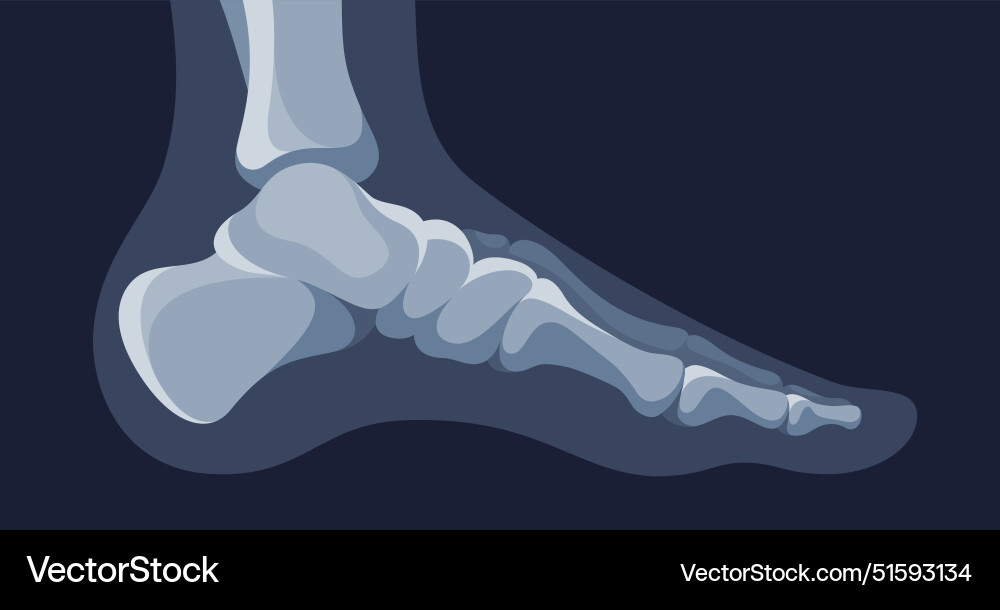Human foot xray structure roentgen radiology image