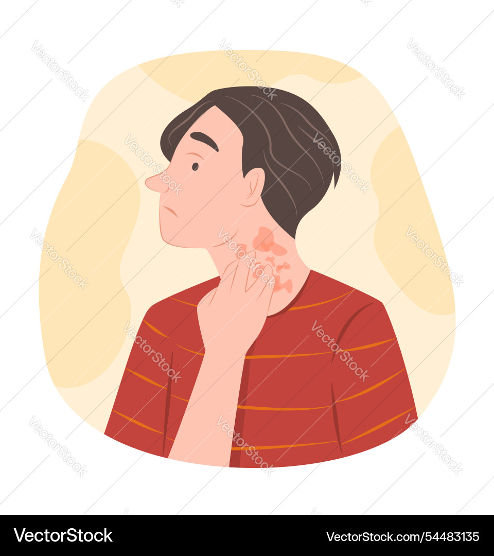 Mann mit atopischer Dermatitis oder Ekzem am Hals Vektorbild