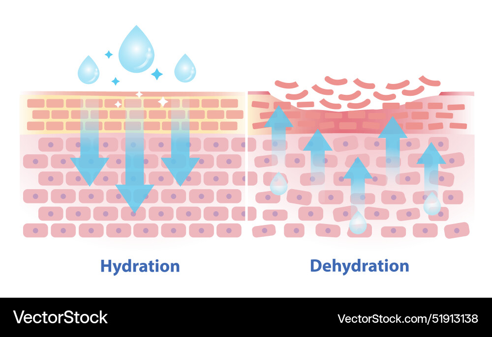 Mechanism of hydration and dehydration skin Vector Image Mechanism of hydration and dehydration skin Vector Image
