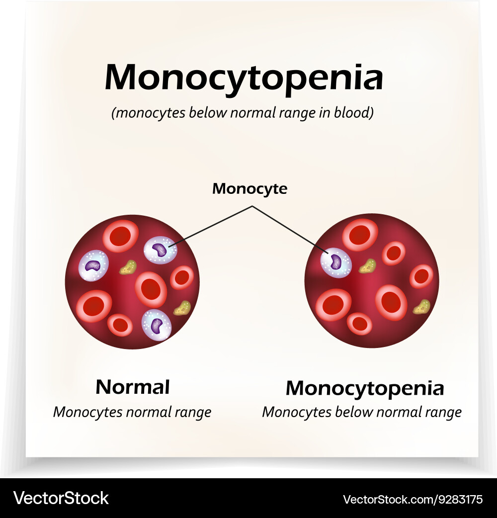 Monocytes below the normal range in blood Vector Image
