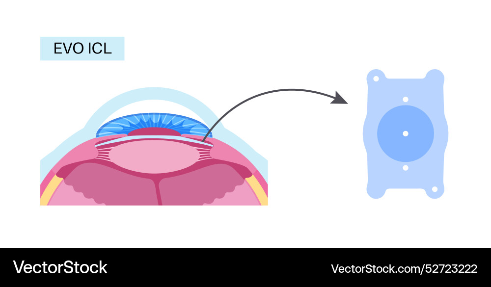 Evo icl poster Royalty Free Vector Image - VectorStock