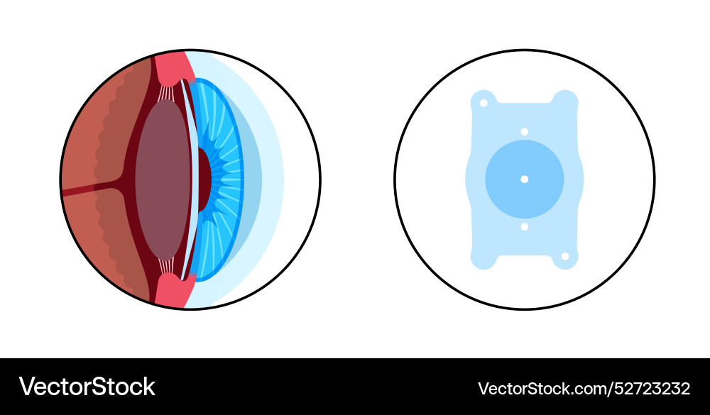 Evo icl poster Royalty Free Vector Image - VectorStock