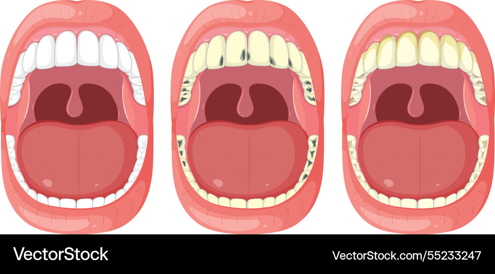 Three mouths showing different dental health Vector Image