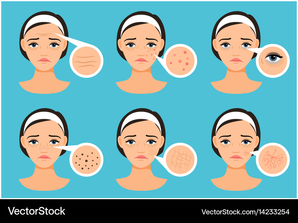 Female face with skin problems Royalty Free Vector Image