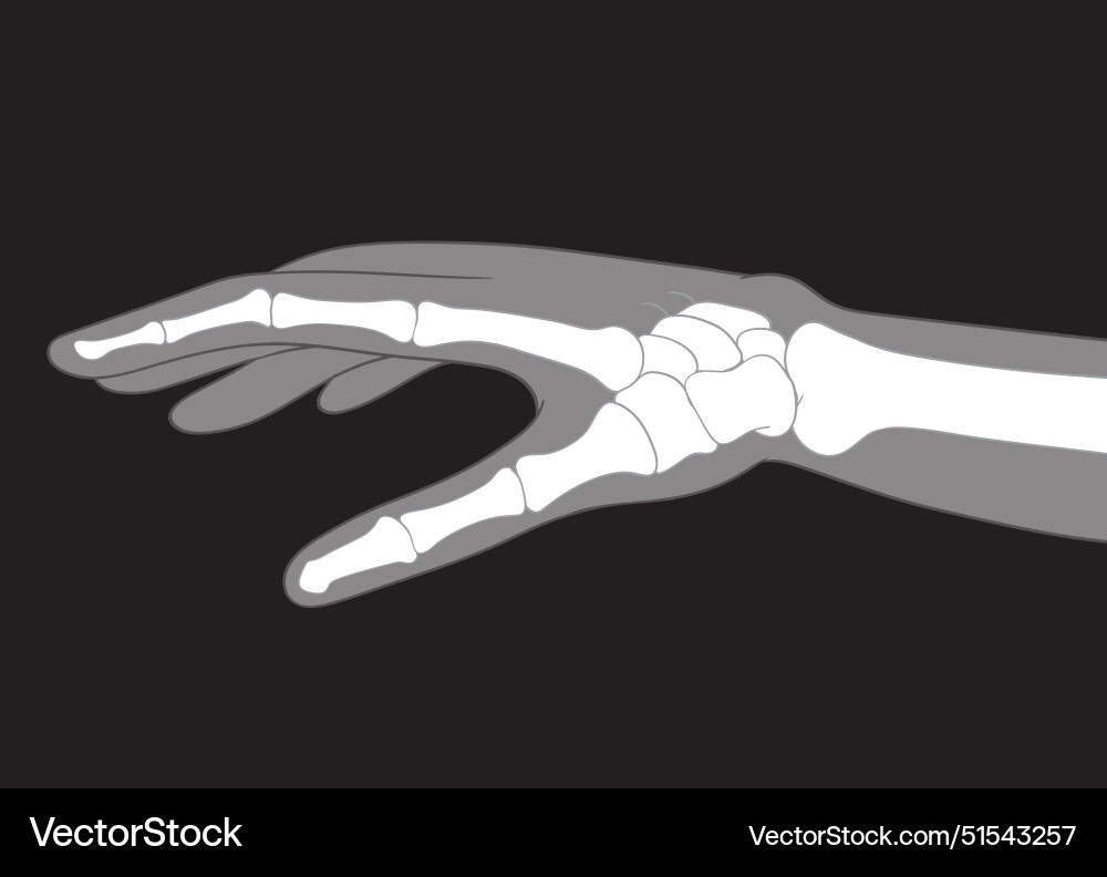 A hand x-ray Royalty Free Vector Image - VectorStock