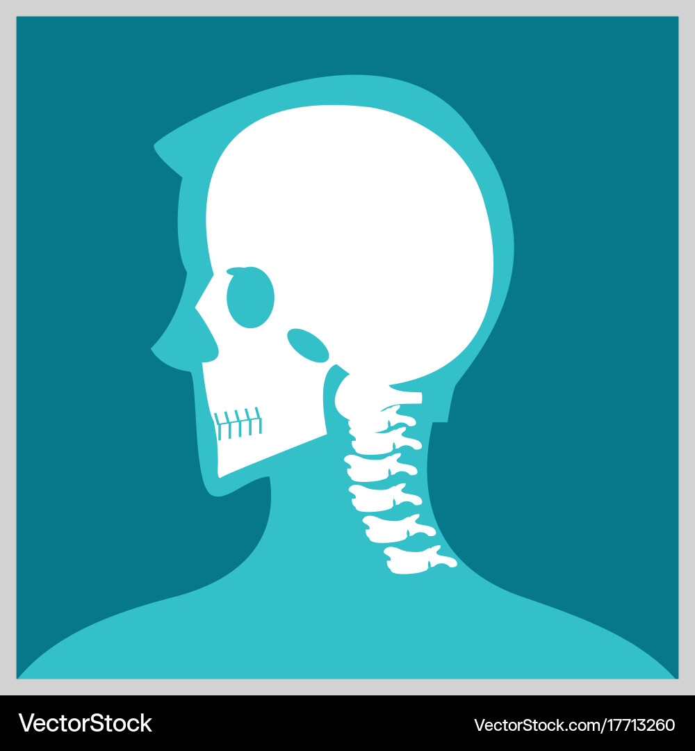 Kopf und Hals X-Ray Lizenzfreies Vektorbild - VectorStock