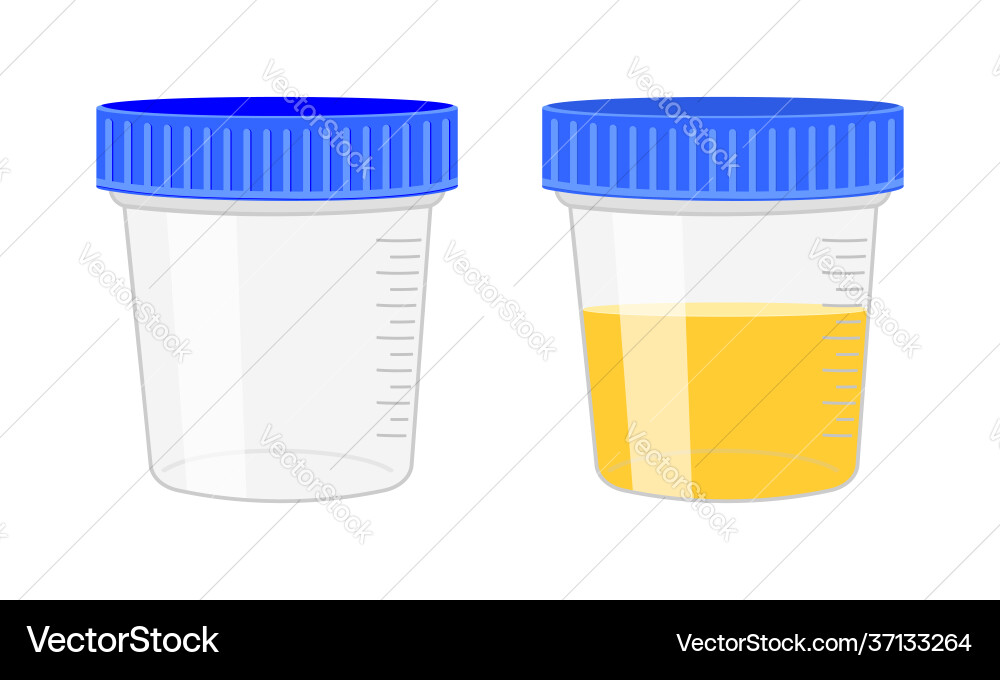 Urinalysis urine sample empty and full plastic Vector Image