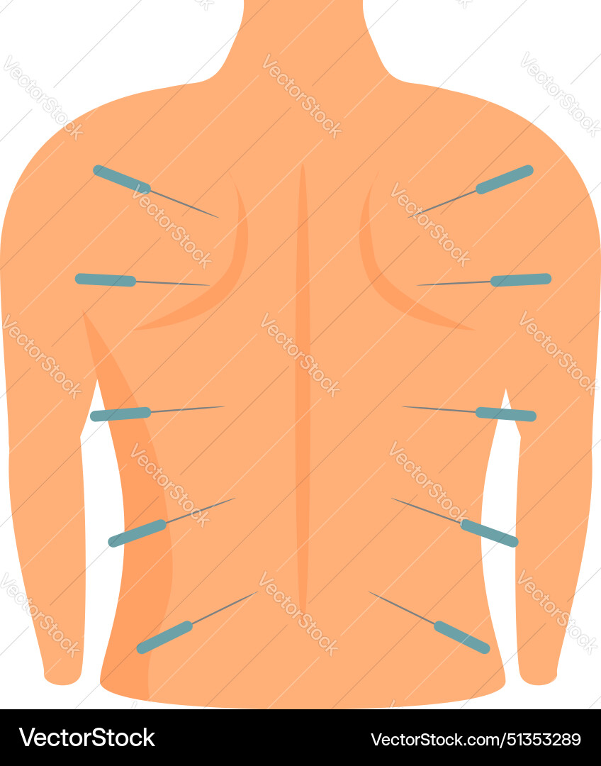 Showing acupuncture needles Royalty Free Vector Image