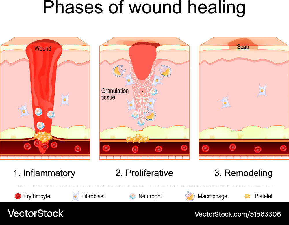 Wound healing process tissue repair Royalty Free Vector