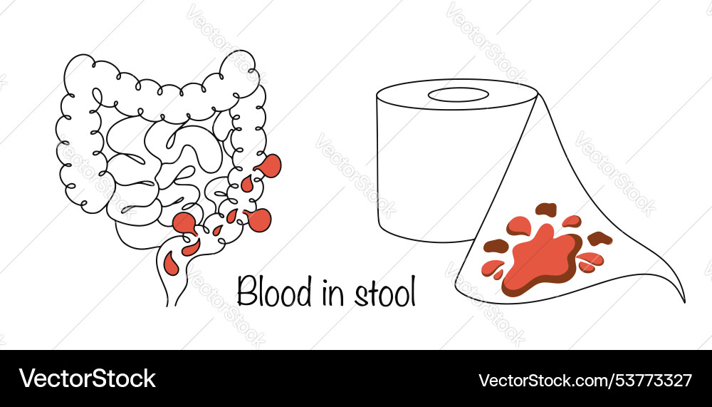 Blood in stool Royalty Free Vector Image - VectorStock