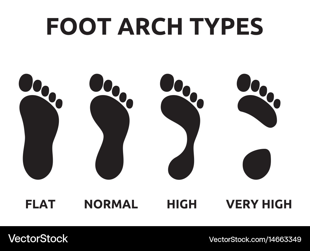Foot arch types Royalty Free Vector Image - VectorStock