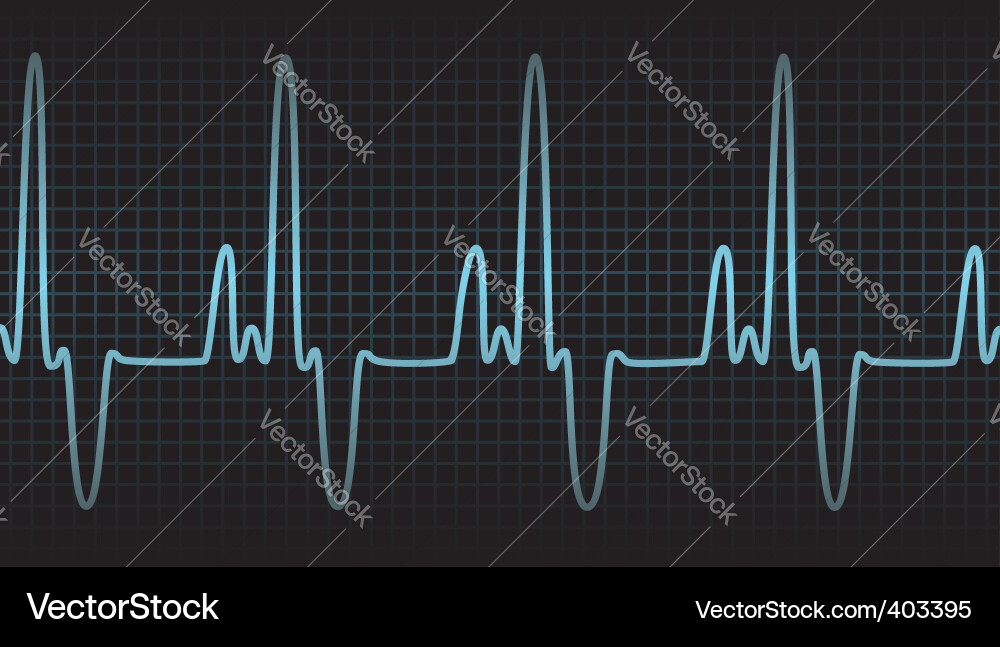 Electrocardiogram Royalty Free Vector Image - VectorStock