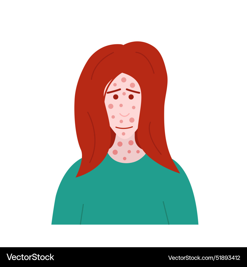 Monkey pox outbreak Royalty Free Vector Image - VectorStock