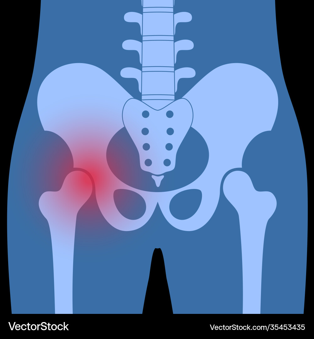 Human Bone Pain Concept Royalty Free Vector Image