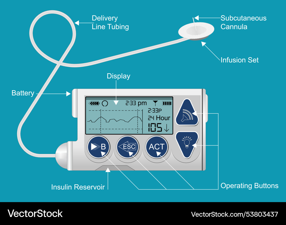 Structure of generic insulin infusion pump Vector Image