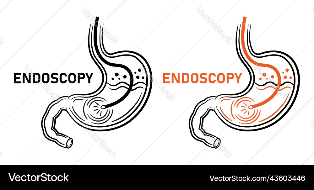 Endoscopy stomach endoscope gastroscopy procedure Vector Image