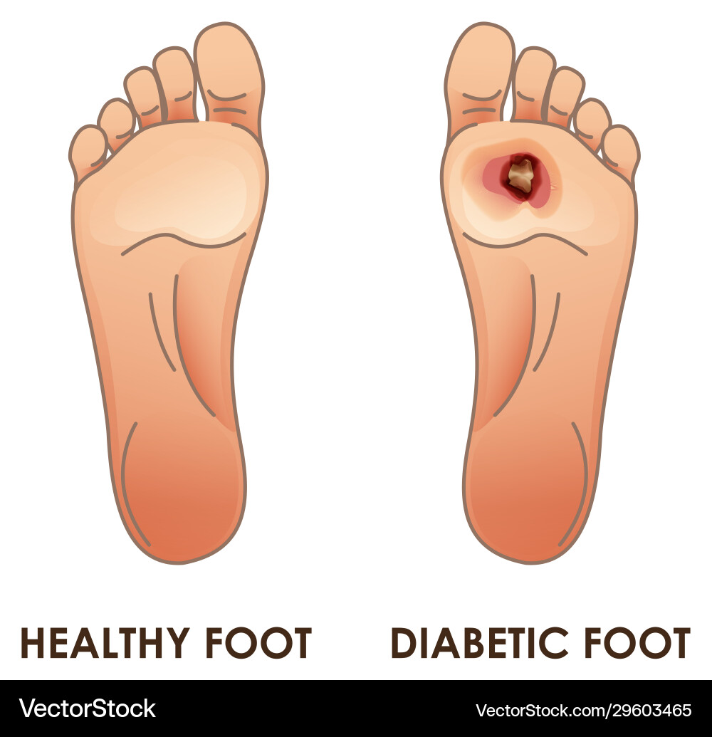 Skin Blister Vector Images (over 1,200)