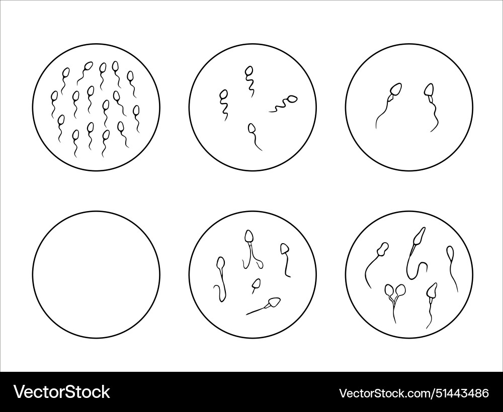 Sperm pathologies spermogram Royalty Free Vector Image