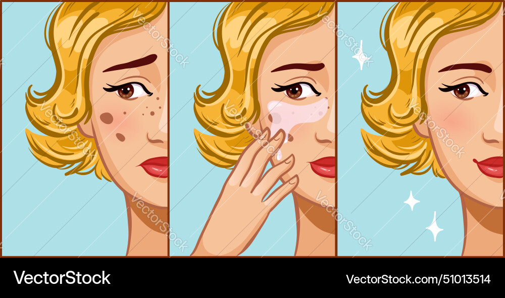 Woman face with spot melasma pigmentation Vector Image