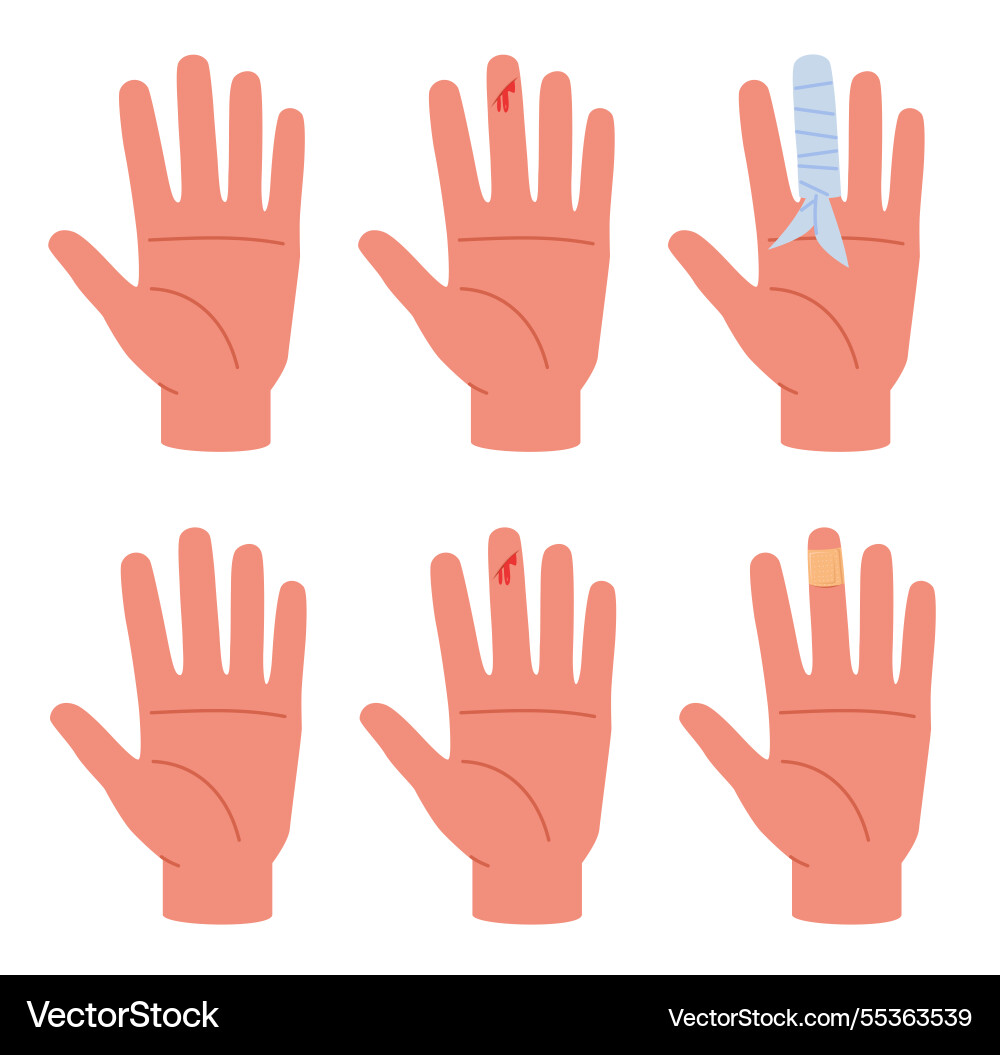 Ways to treat cut hand bleeding wound Royalty Free Vector