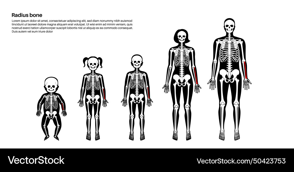 Radius bone anatomy Royalty Free Vector Image - VectorStock