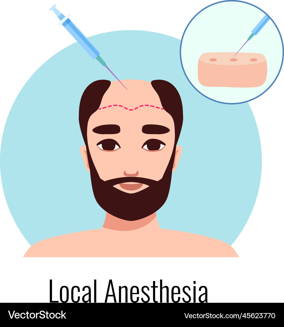 Male alopecia anesthesia composition Royalty Free Vector