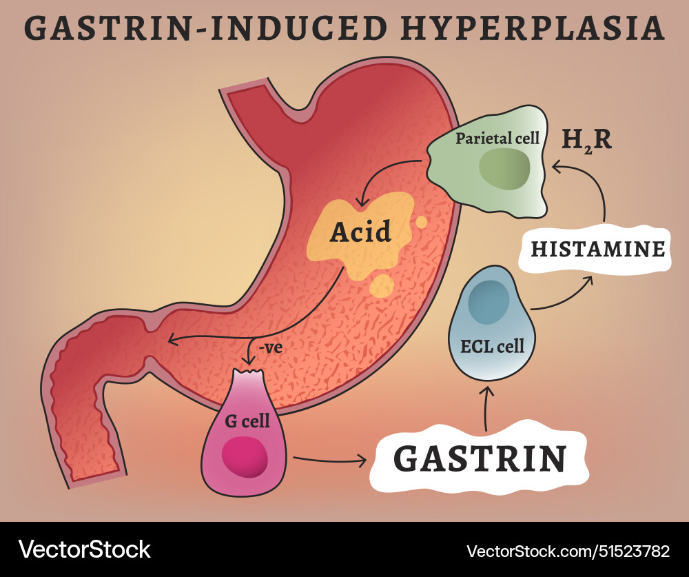 Gastrin-induced hyperplasia gastric acid Vector Image