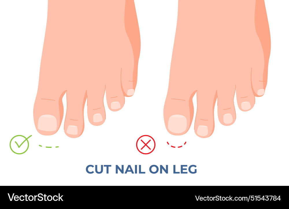 How to cut toenails correctly so that pain does Vector Image