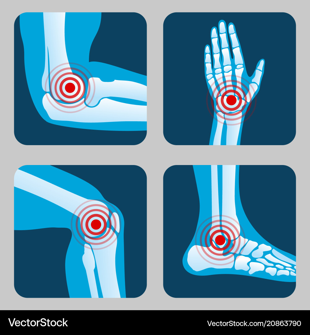 Human joints with pain rings arthritis Royalty Free Vector