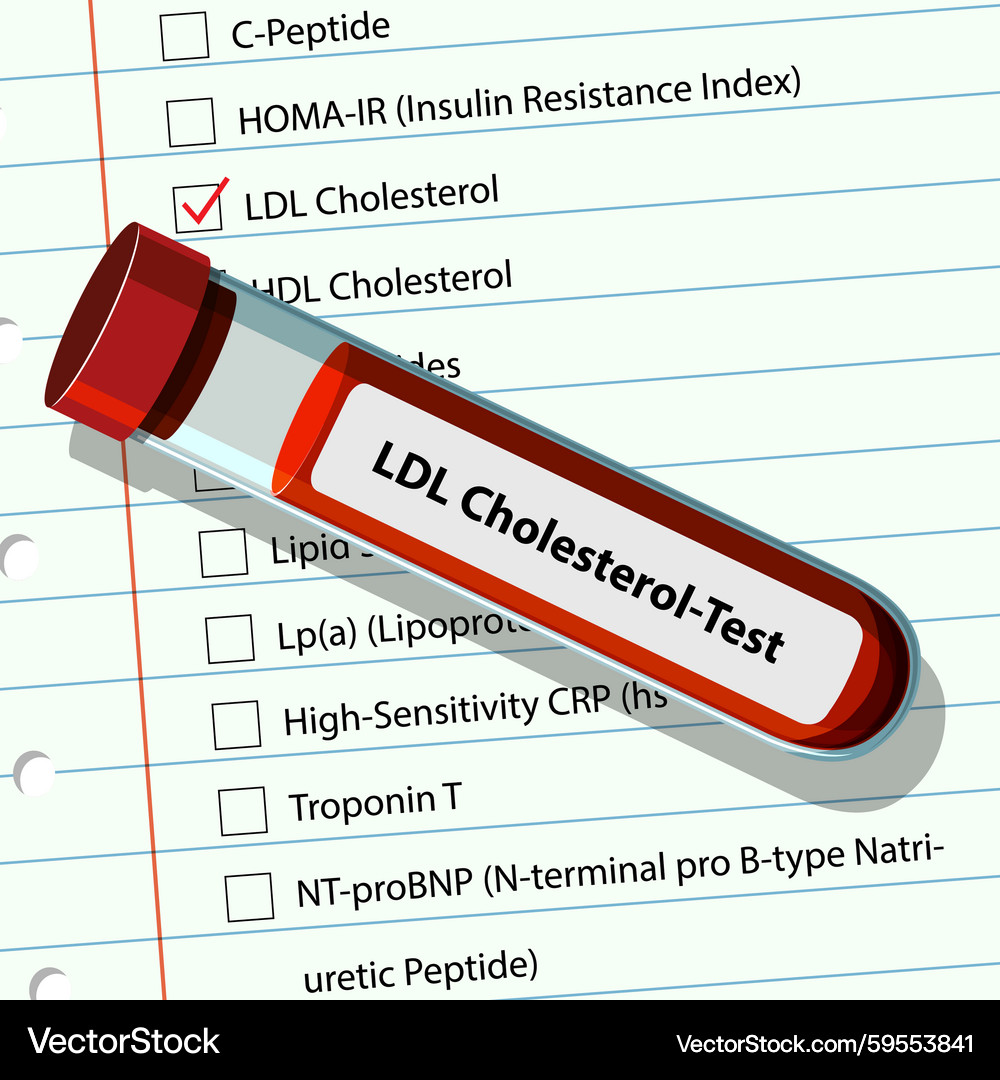 Blood Test Checklist and Vial Royalty Free Vector Image