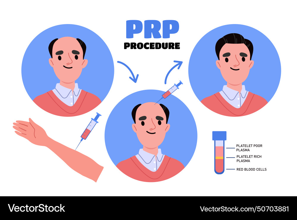 Prp procedure concept Royalty Free Vector Image