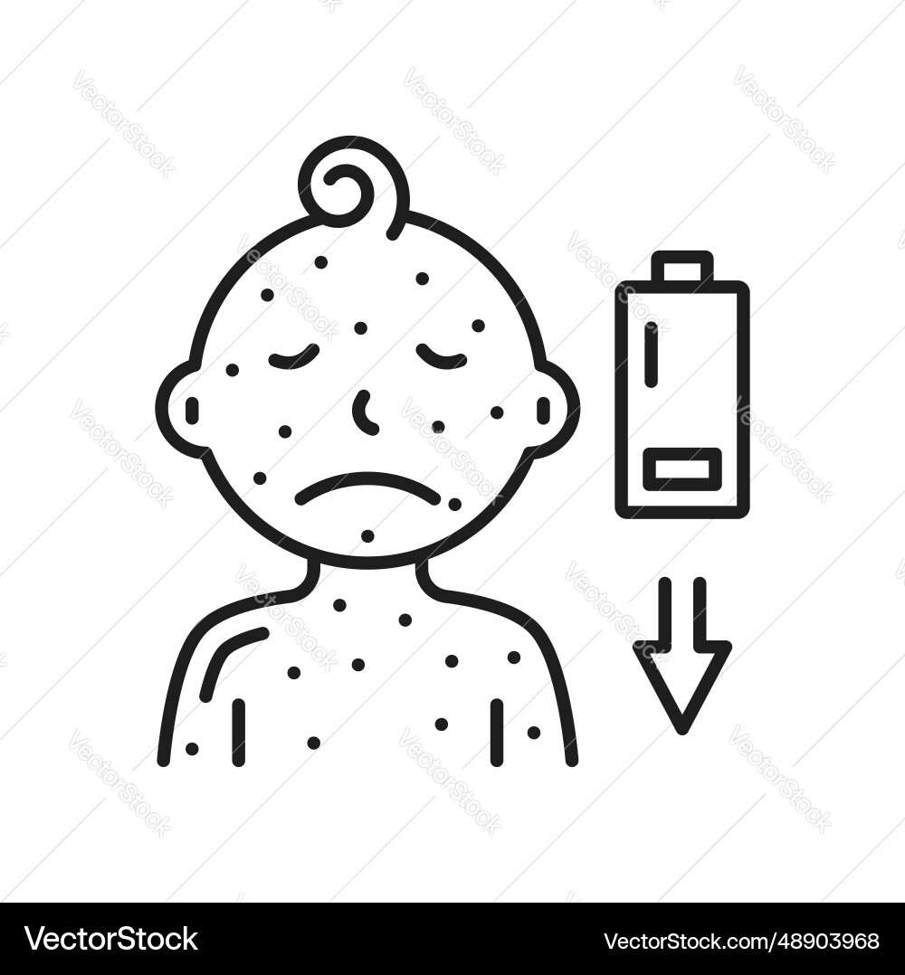Chickenpox treatment ointment varicella disease Vector Image