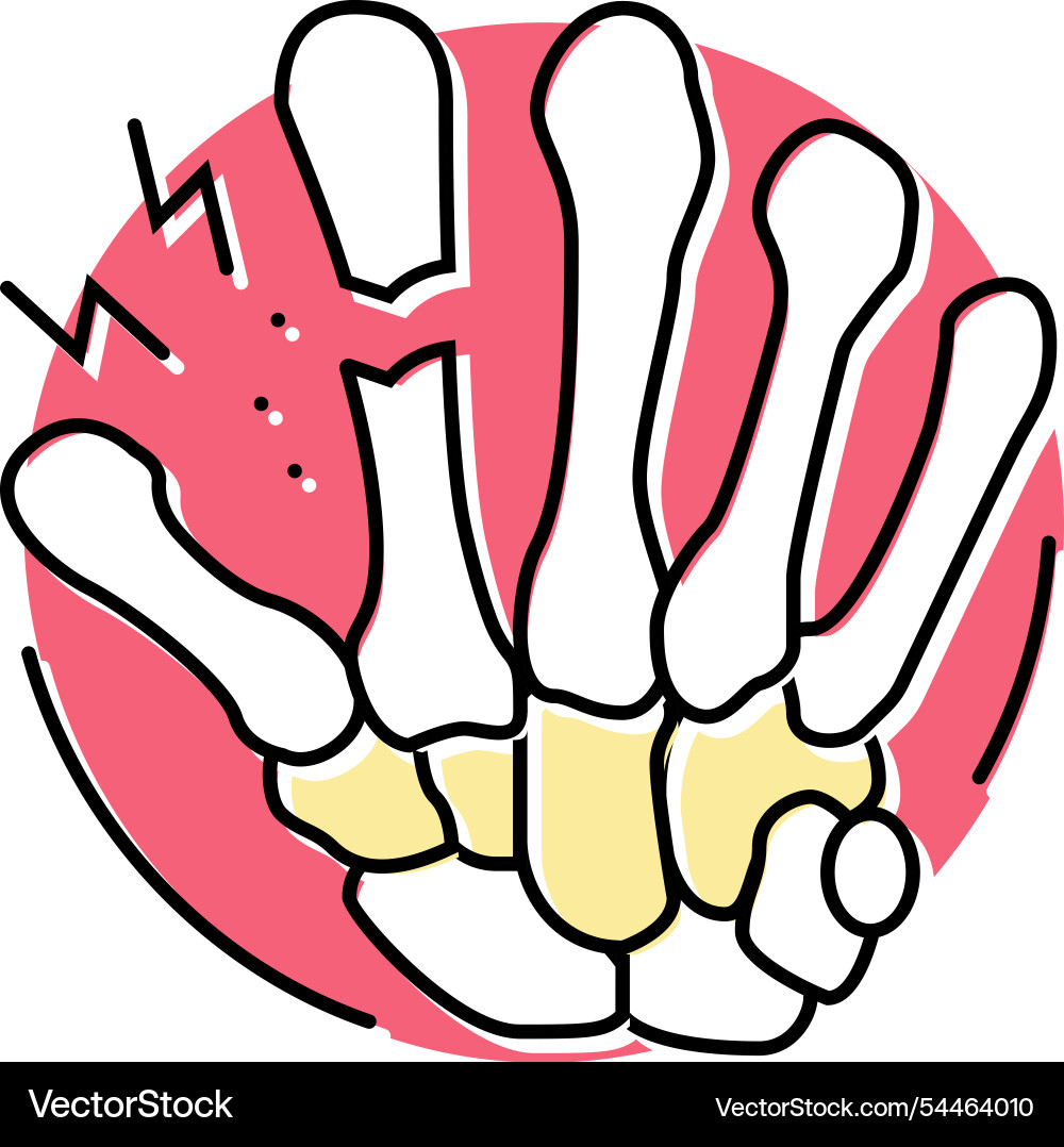 Fracture hand bones osteoporosis color icon Vector Image