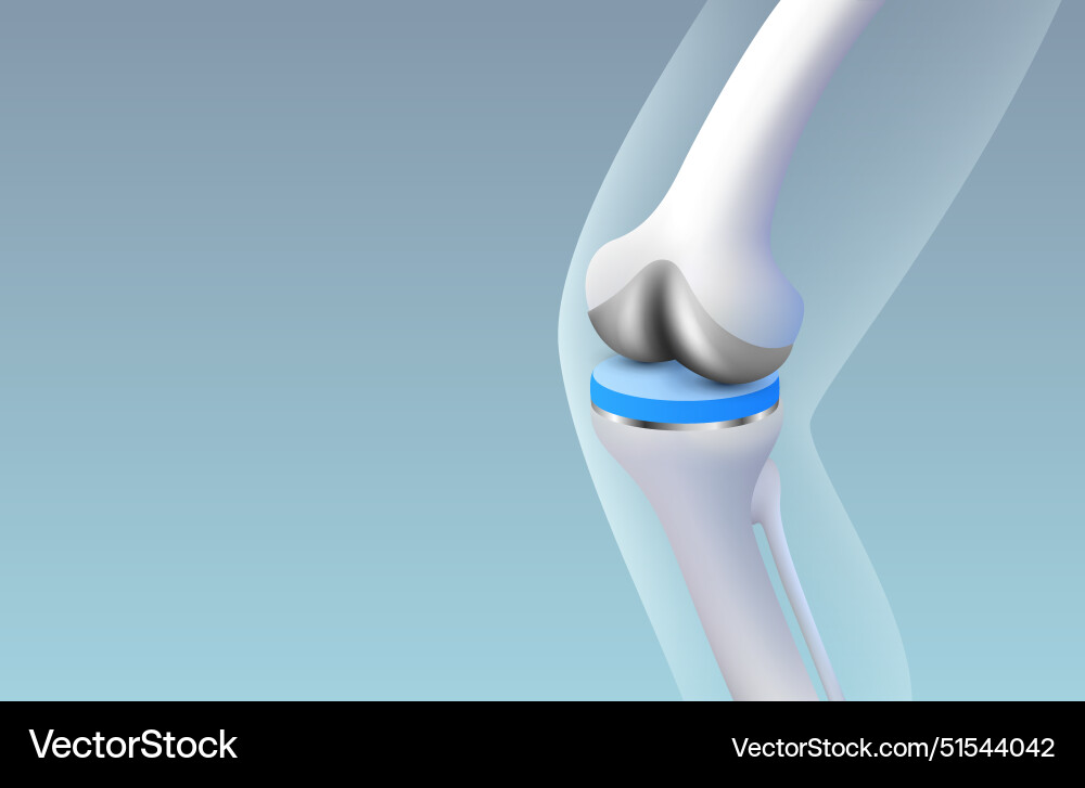 Knee implant x-ray of the leg 3d visualization Vector Image