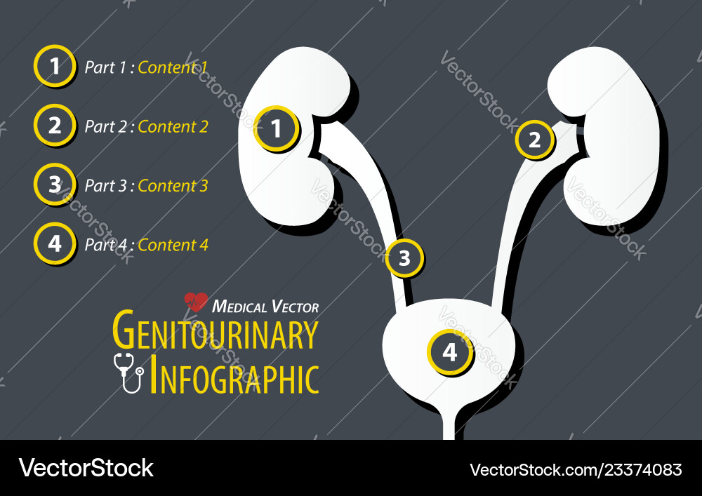 Genitourinary infographic flat design Royalty Free Vector
