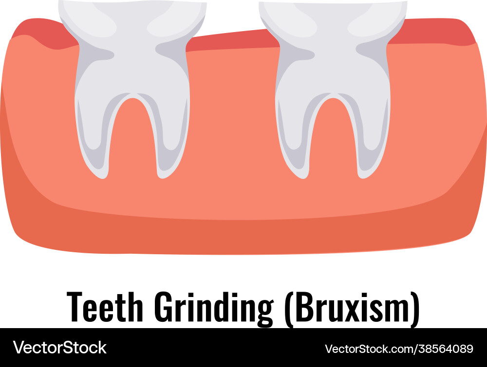 Dental problem poster Royalty Free Vector Image