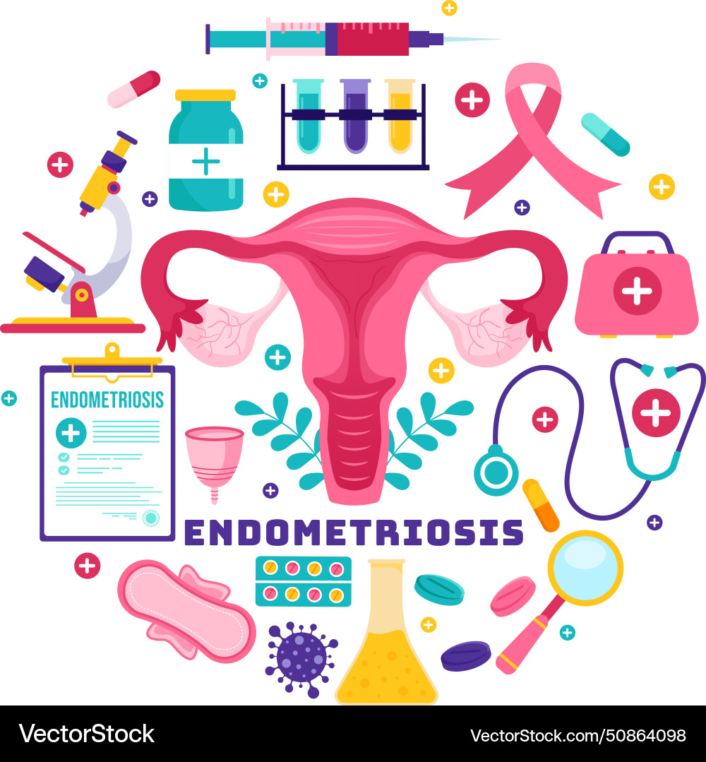 Endometriosis with condition the endometrium Vector Image
