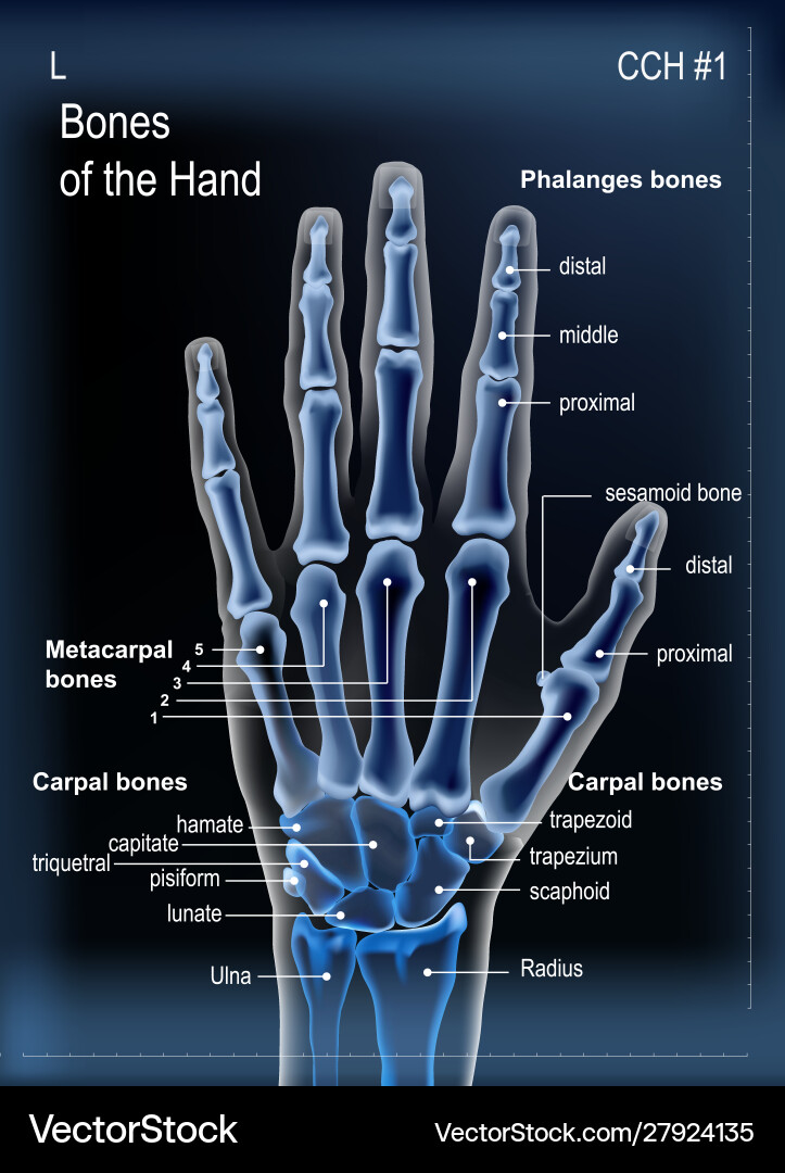 Carpal Bones Anterior View