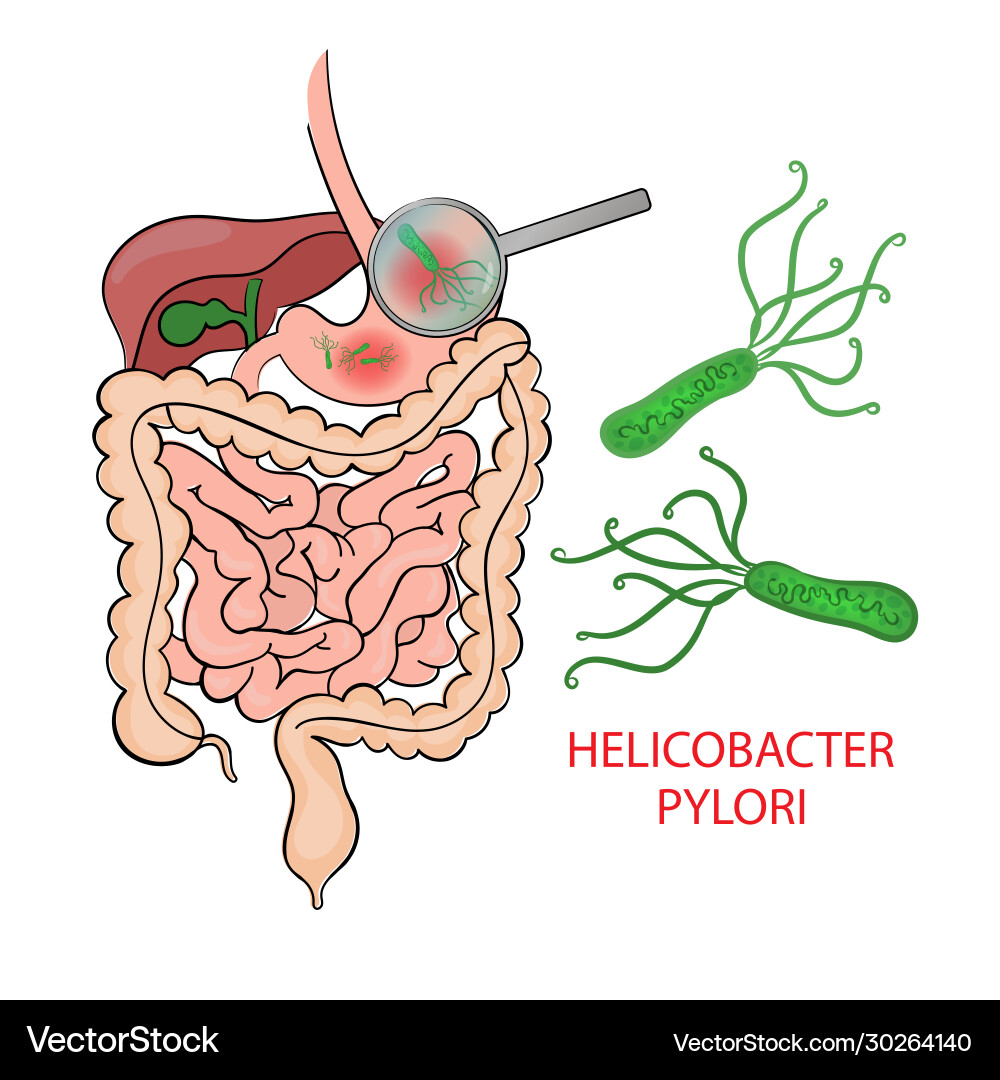 Helicobacter pylori medicine education diagram vec