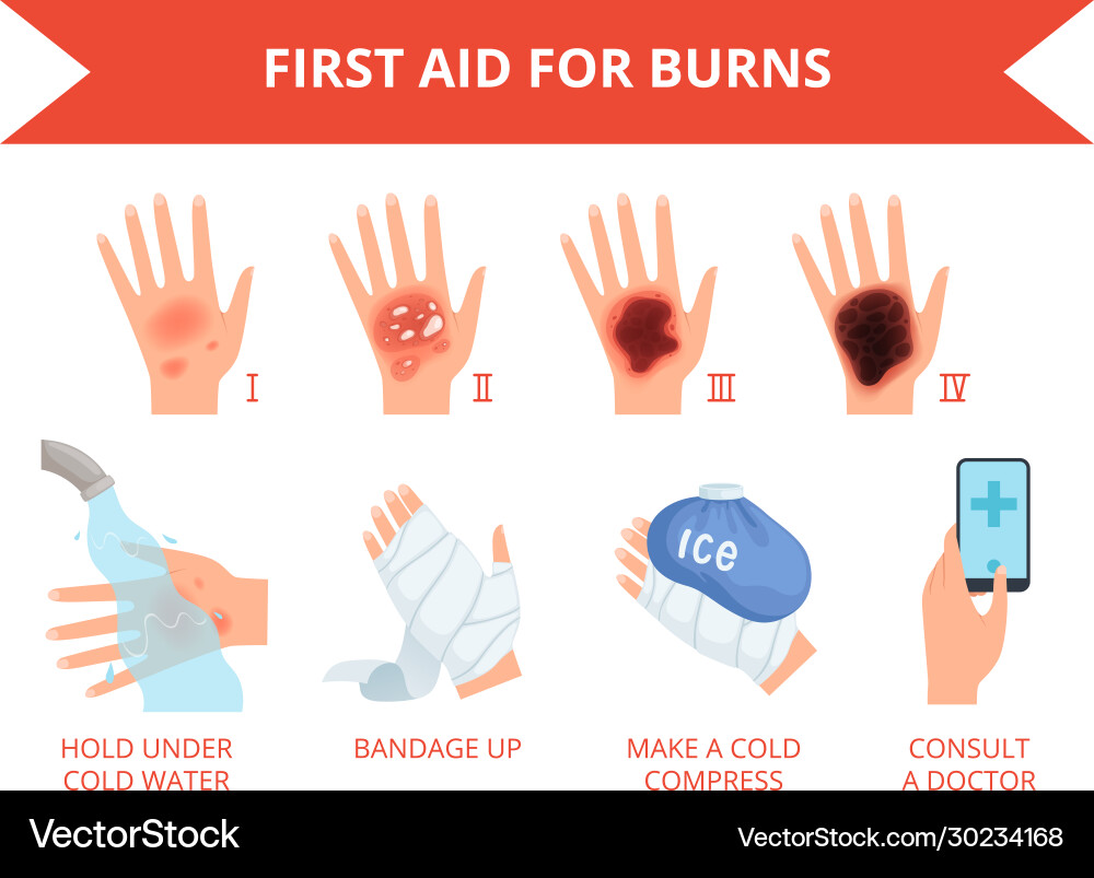 Third Degree Burn Vector Images (26)