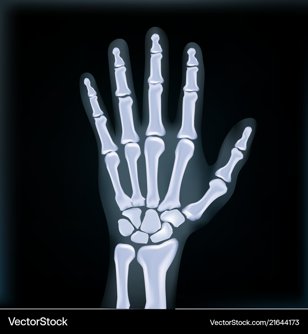 Realistic x-ray hand medical image Royalty Free Vector Image