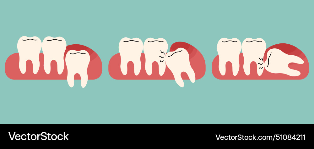 Wisdom teeth 1 Royalty Free Vector Image - VectorStock