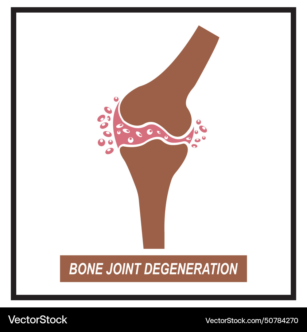 Bone joint degeneration icon Royalty Free Vector Image
