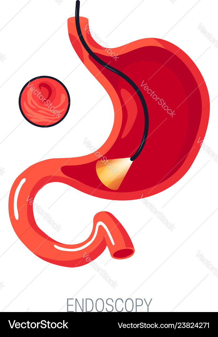 Endoscopy Diagnostic - Stomach with Scope Vector Image