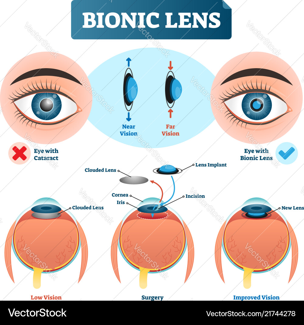 Bionic lens vision structure Royalty Free Vector Image