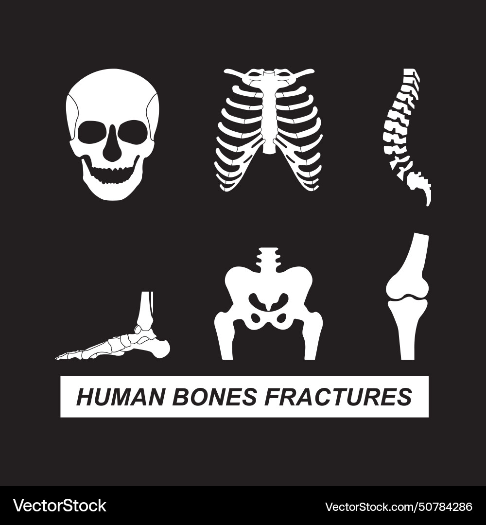 Human bones fractures icon Royalty Free Vector Image